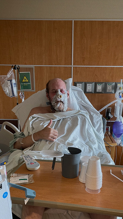 Hombre de EE. UU. recibe el primer trasplante completo de ojo y parte de su cara