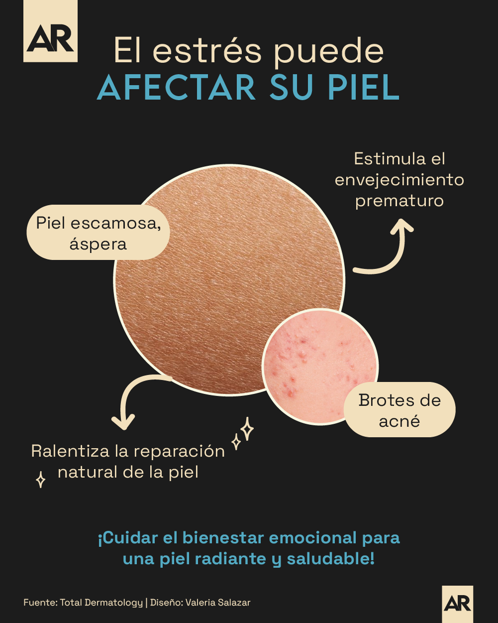 ¿Cómo el estrés puede afectar la piel?